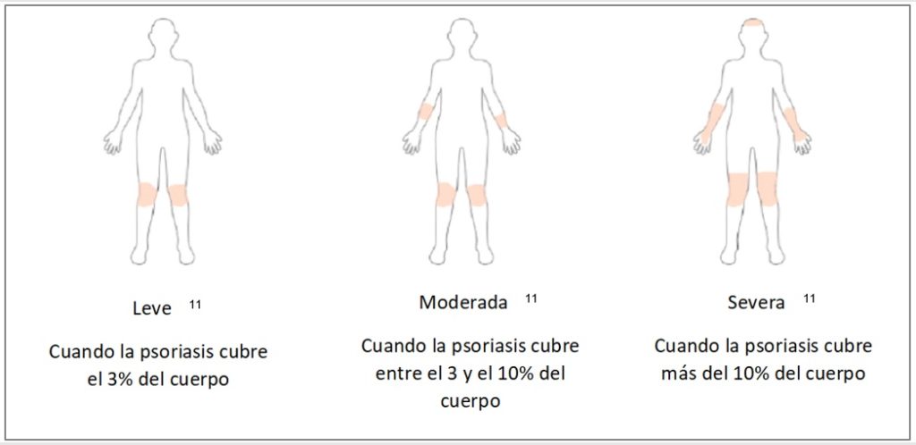 Revista es, Ejercicio y Salud – Psoriasis: una enfermedad, muchas ...